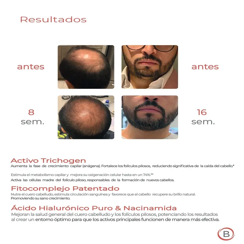 Shampoo Anti-Caida - 25 en CONAFAR